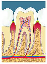 Ursachen von Parodontalerkrankungen