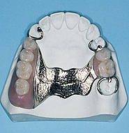 Herstellung von Teilprothesen